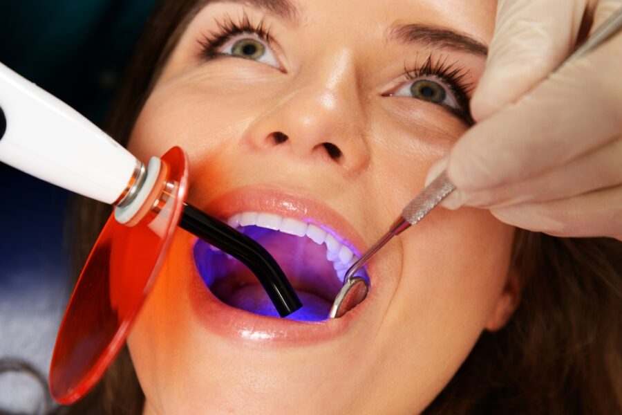 Dental Bonding in Orlando, FL